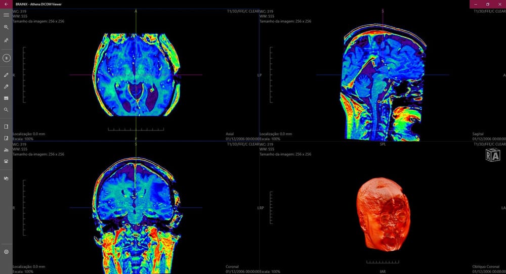 Top 15 FREE DICOM Viewers