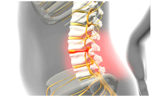 Understanding the Difference Between a Herniated Disc and a Spinal Cord ...