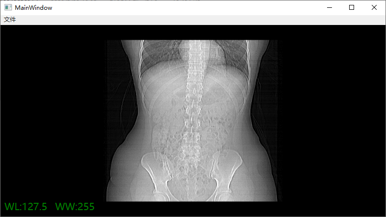 DWV (DICOM Web Viewer) is a Free Web-based DICOM Viewer