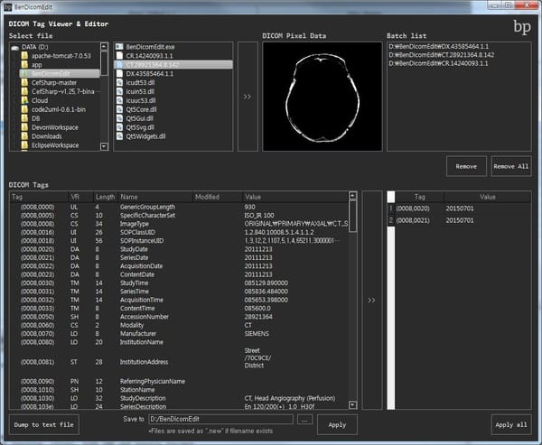 17 Top Open-source Free DICOM Viewers For Medical Professionals