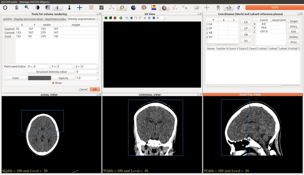 25 Free & open source DICOM Viewers for Windows