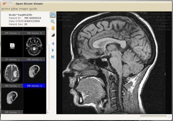 17 Top Open-source Free DICOM Viewers For Medical Professionals